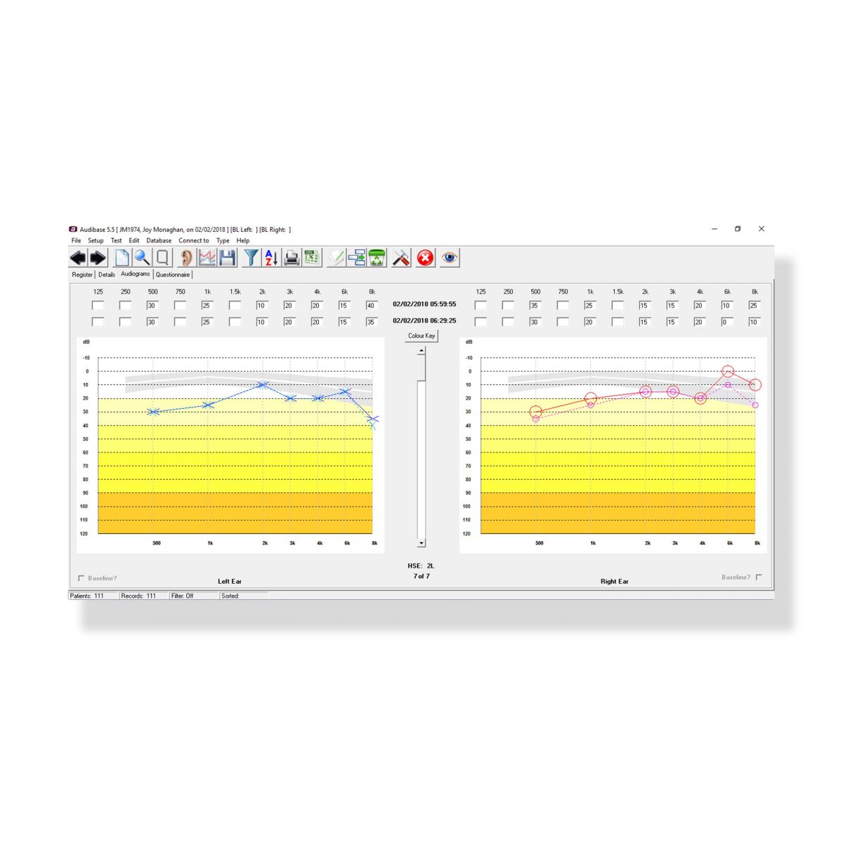 Amplivox Audibase 5.5 Audiometry PC Software